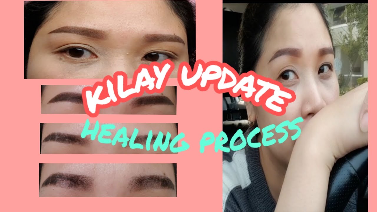 MICROSHADING UPDATE|HEALING PROCESS - YouTube