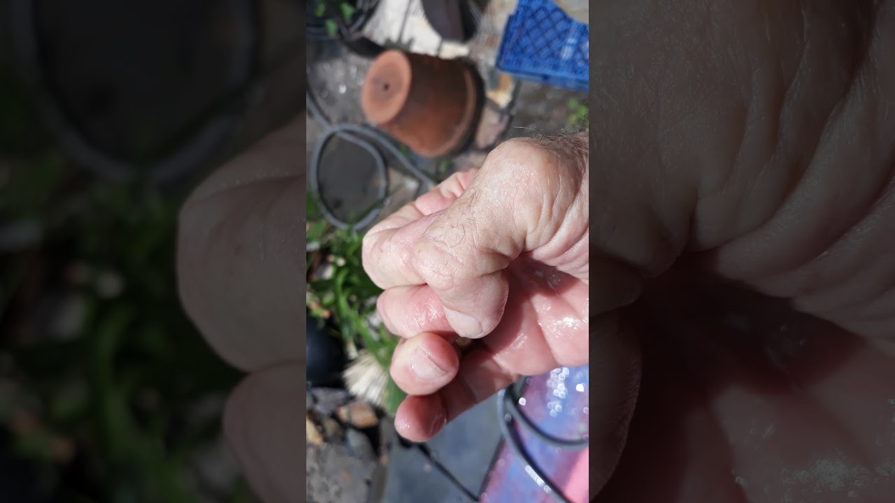 Calling doctor moe doctor larry doctor mike - YouTube