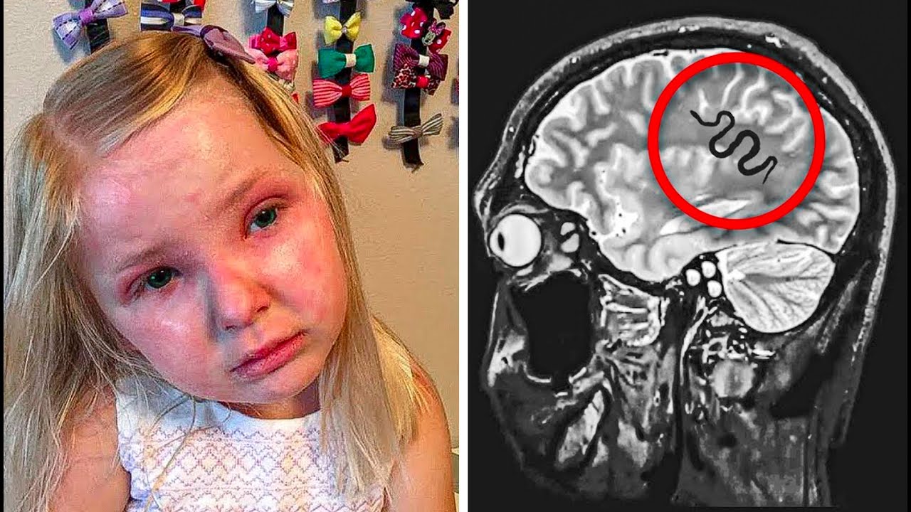This Girl Was Told Her Brain Tumor Was Inoperable, But when it was time ...