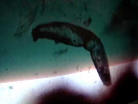 ACNE MOVIE - YouTube