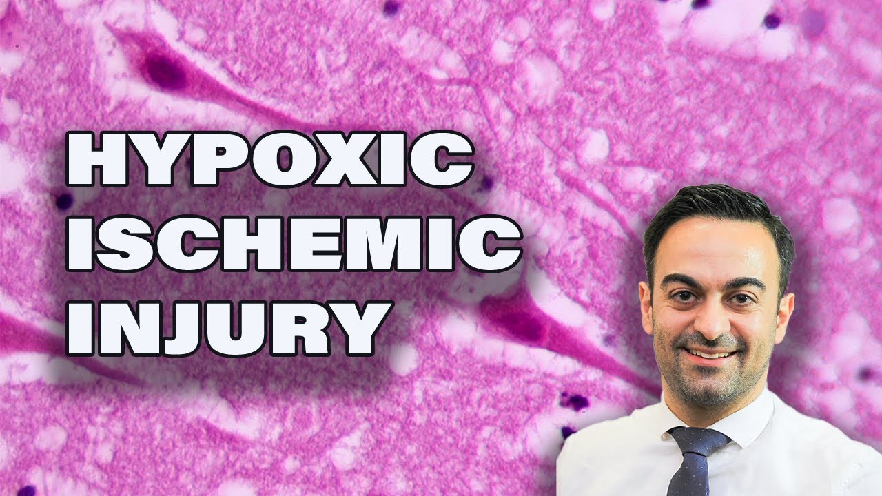 Hypoxic Ischemic Injury: Mechanisms and Neuropathology - YouTube