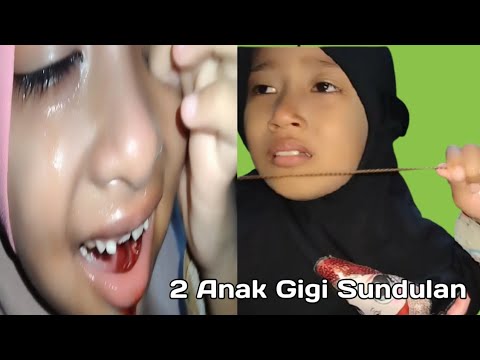 2 anak Gigi Sundulan - YouTube