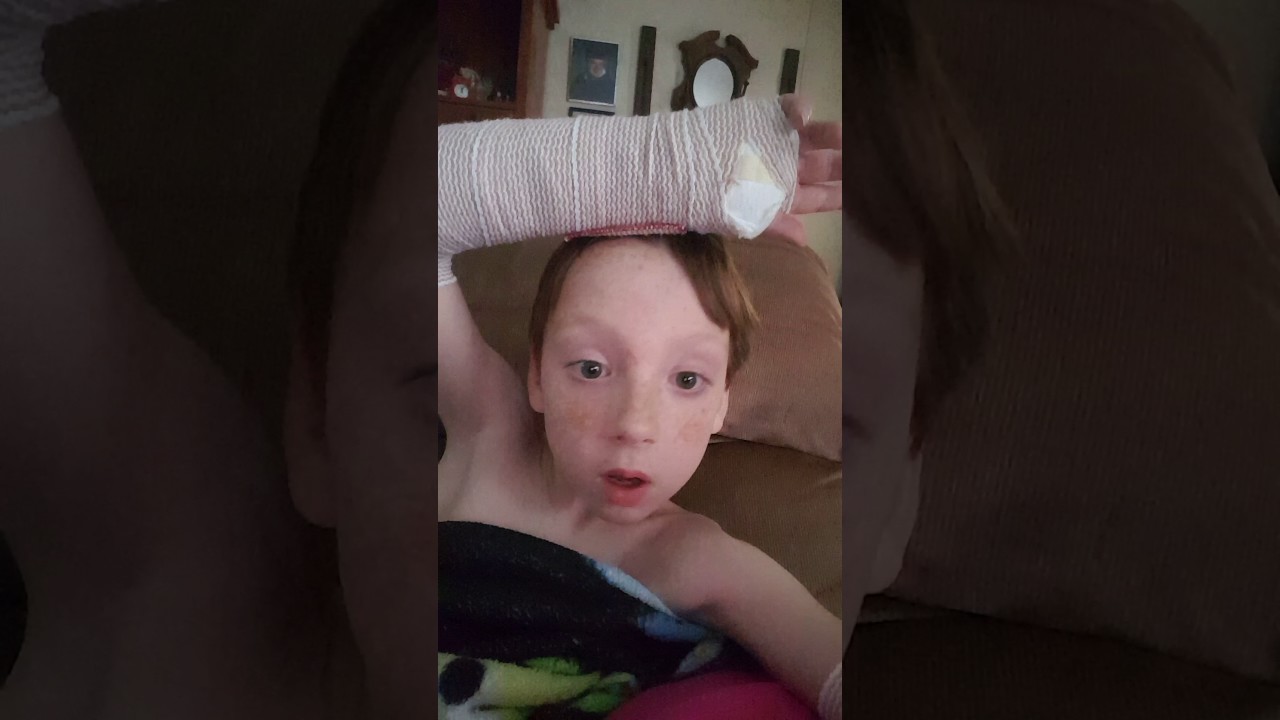 I fractured both of my wrists... - YouTube