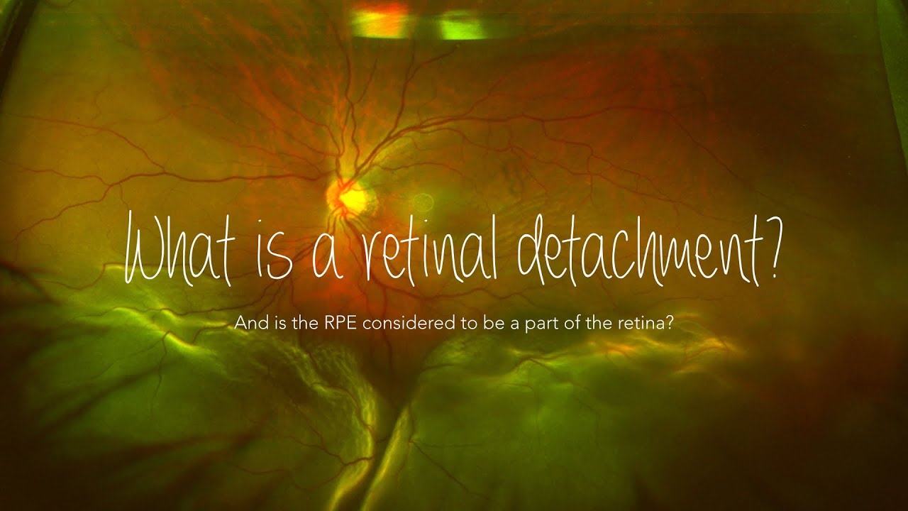 Retinal Detachment Animation Youtube