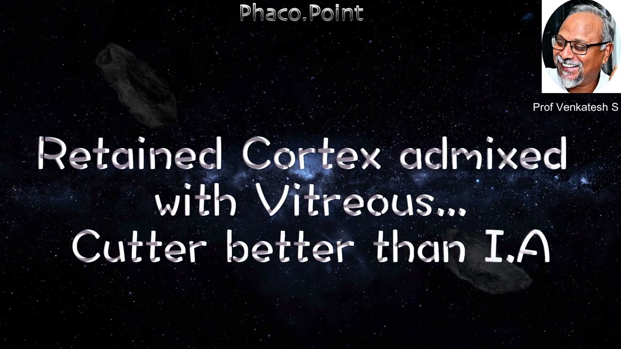 Post op Retained cortex with Admixed Vitreous - Cutter works both as ...