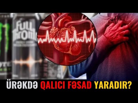 Bu İçkilər Ürək Qüsuruna Səbəb Olur!