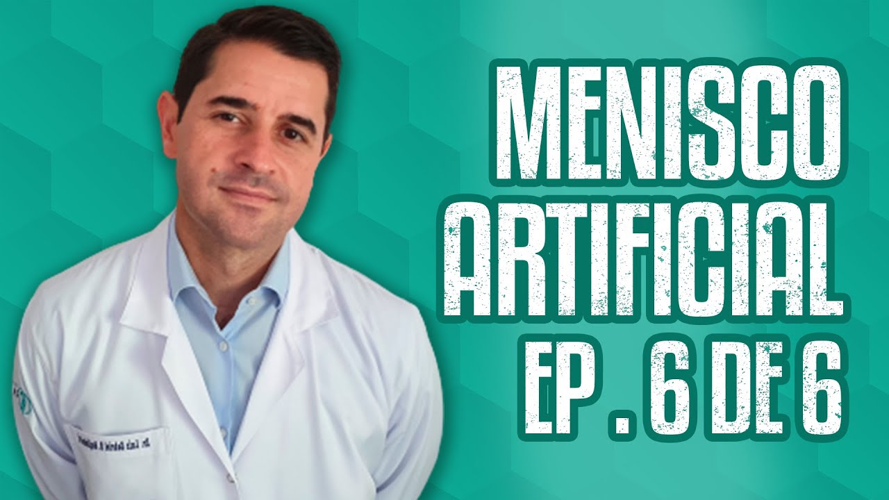 MENISCO ARTIFICIAL e TRANSPLANTE DE MENISCO | Ep. 6 de 6 - YouTube