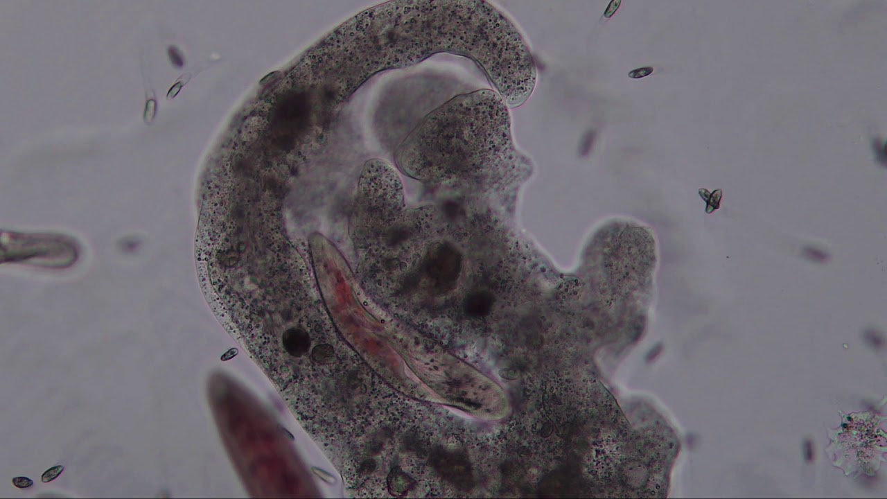 2019 Amoeba captures prey highlights - YouTube
