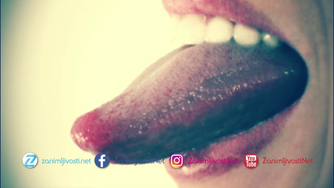 Šta boja jezika može reći o zdravstvenom stanju - YouTube
