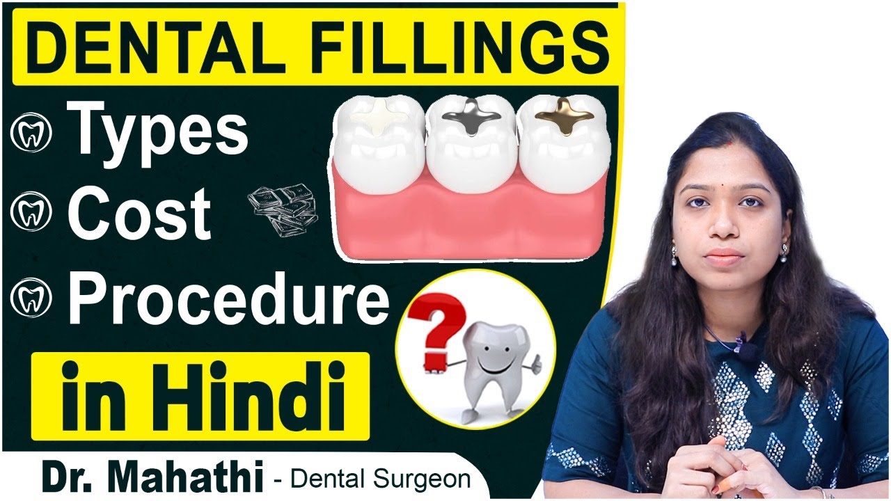 What are Dental Fillings and It's Types | Tooth Filling Procedure in ...