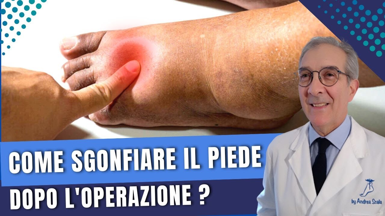 Cosa fare quando si gonfiano i piedi e le caviglie? | Ecco la soluzione ...