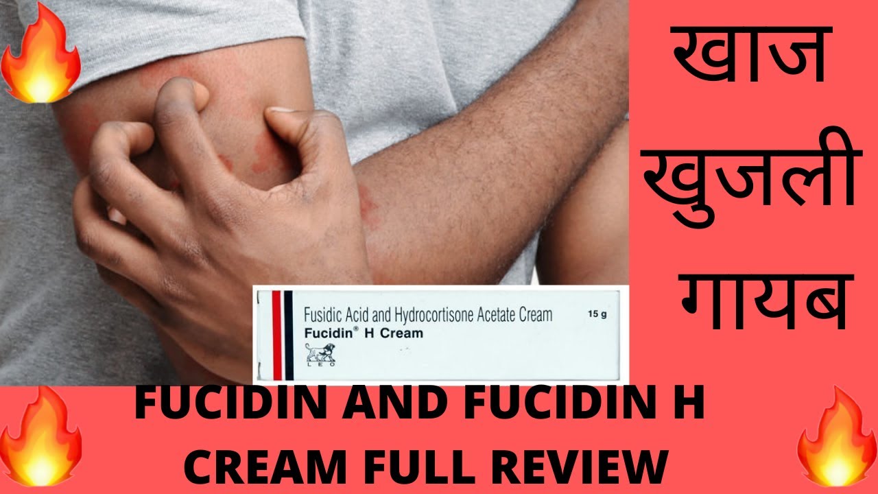 FUCIDIN AND FUCIDIN H CREAM FULL REVIEW HELPFULL IN FUNGAL INFECTION ...