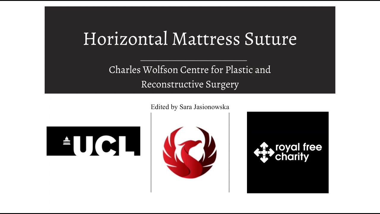Horizontal mattress suture - YouTube