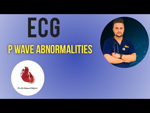 ECG Part 4 : P Wave Abnormalities #ecg - YouTube