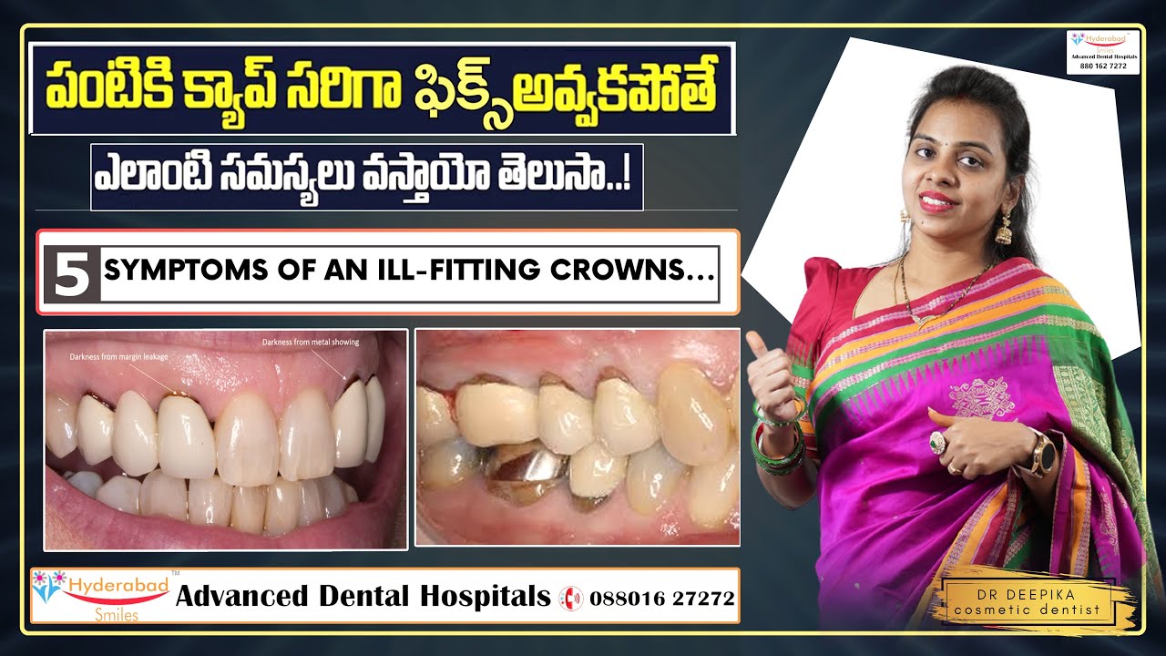 Is your cap not fitting properly? Check for these 5 signs of an ill ...