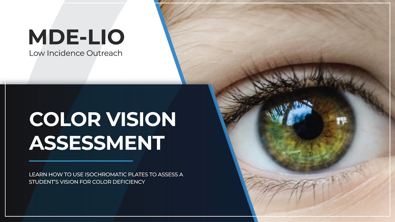 Color Vision Assessment - YouTube