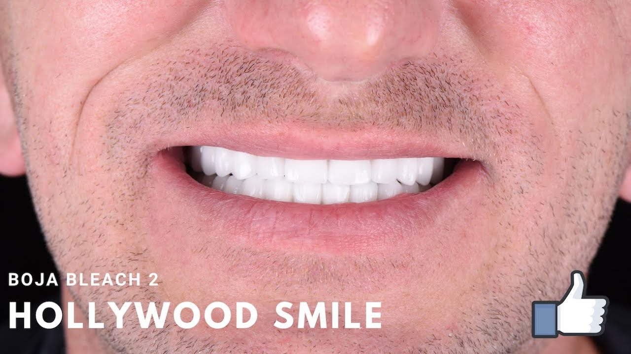 Hollywood smile - Boja Bleach 2 - YouTube