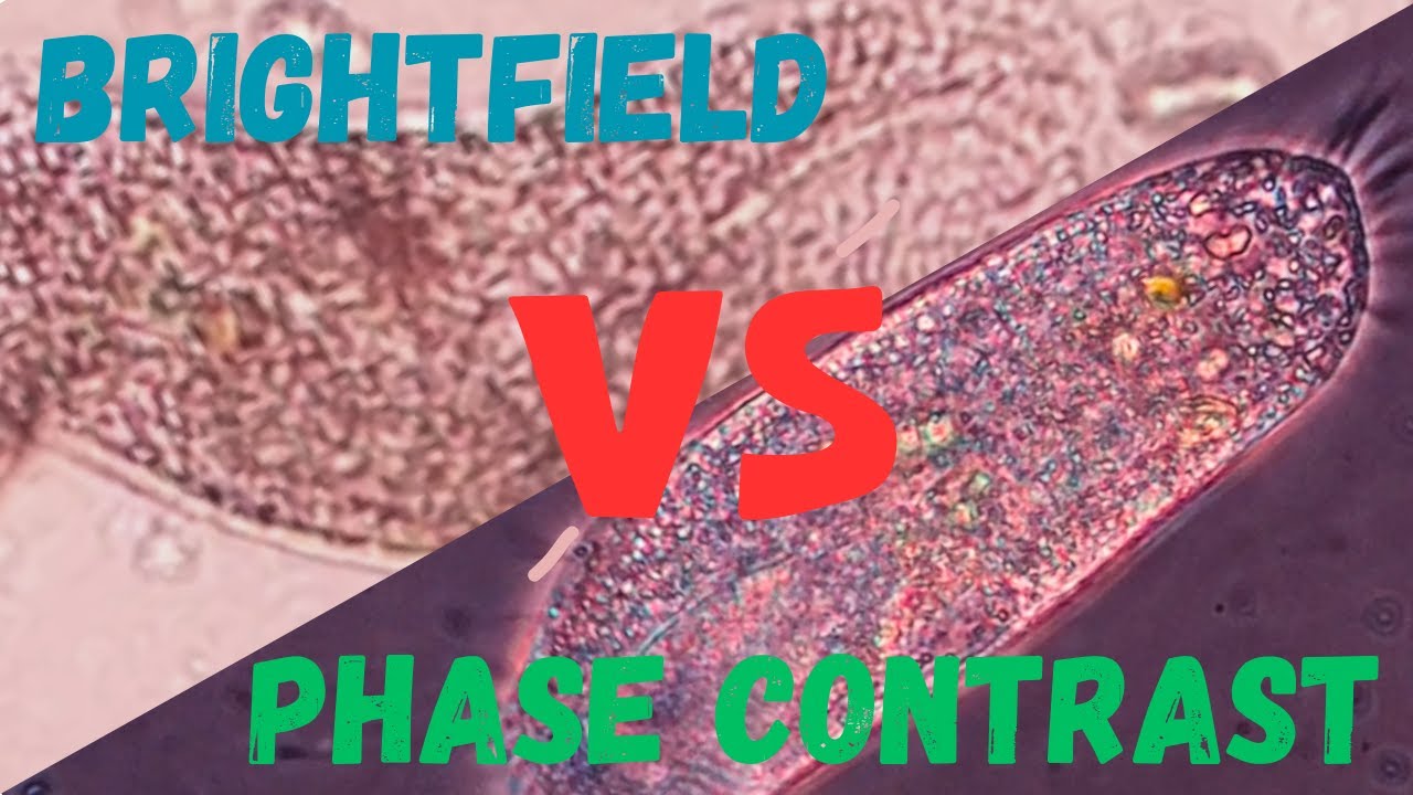 Pond Organisms (+ BACTERIA) under Microscope - Brightfield vs Phase ...