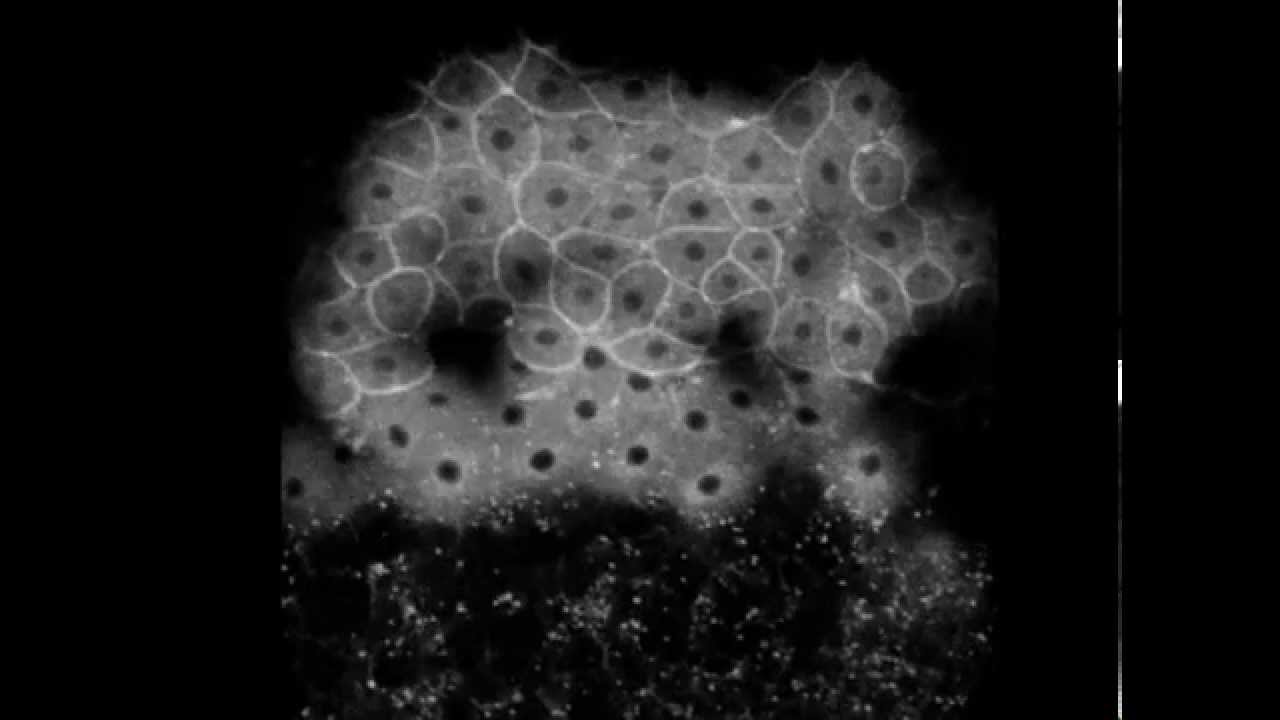 Yolk syncytial layer formation in zebrafish - YouTube