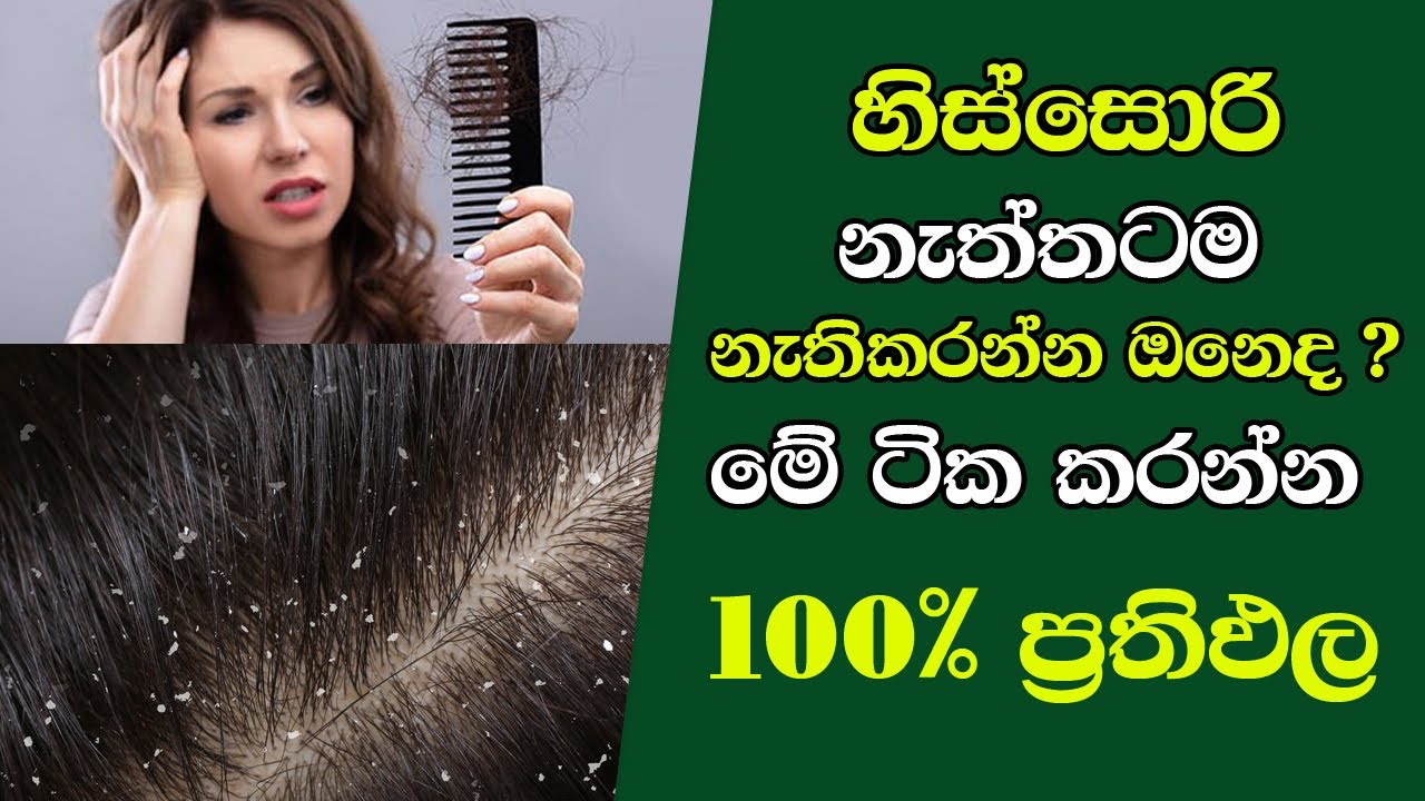How to get rid of dandruff permanently | Hissori walata beheth ...