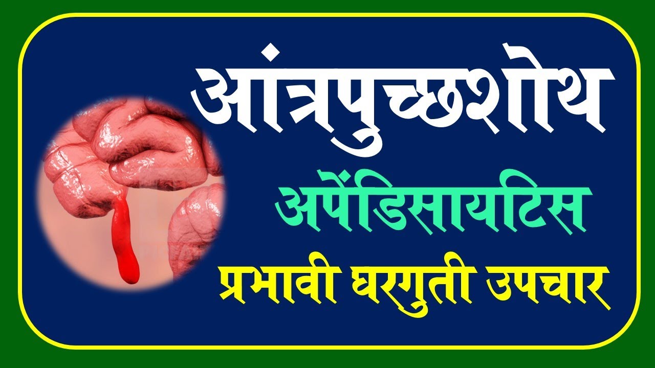 आंत्रपुच्छशोथ - (अपेंडिसायटिस ) घरगुती उपचार / Appendicitis Treatment ...