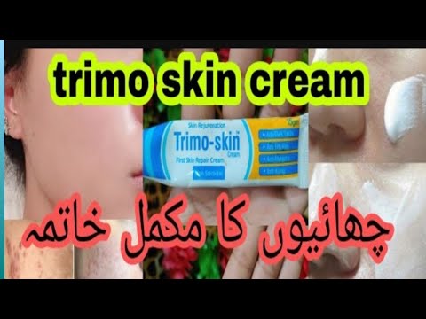 Trimo Skin Cream|| Trimo Skin Cream Ueses & Side Effects|| Honest ...