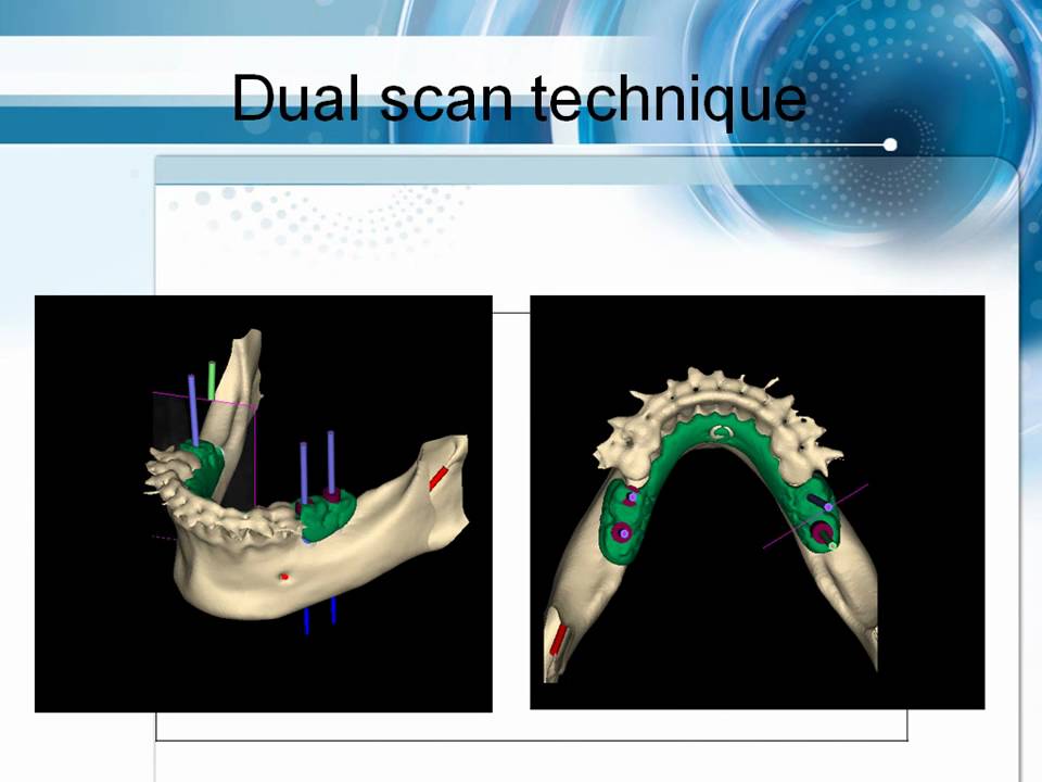 triple scan protocol.wmv - YouTube