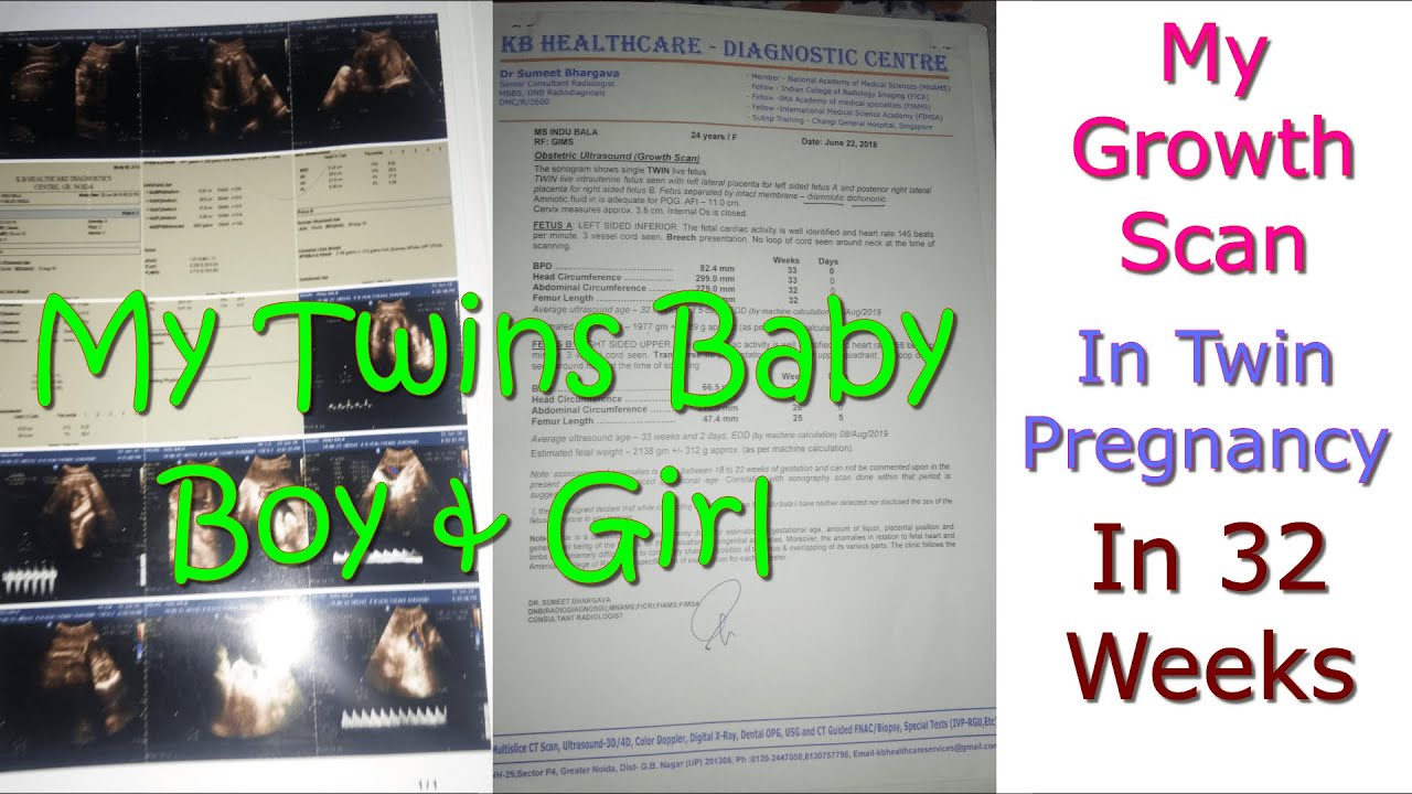 My Growth/Fetal Wellbeing Scan in 32 Week !! Twin Baby Boy & Girl - YouTube
