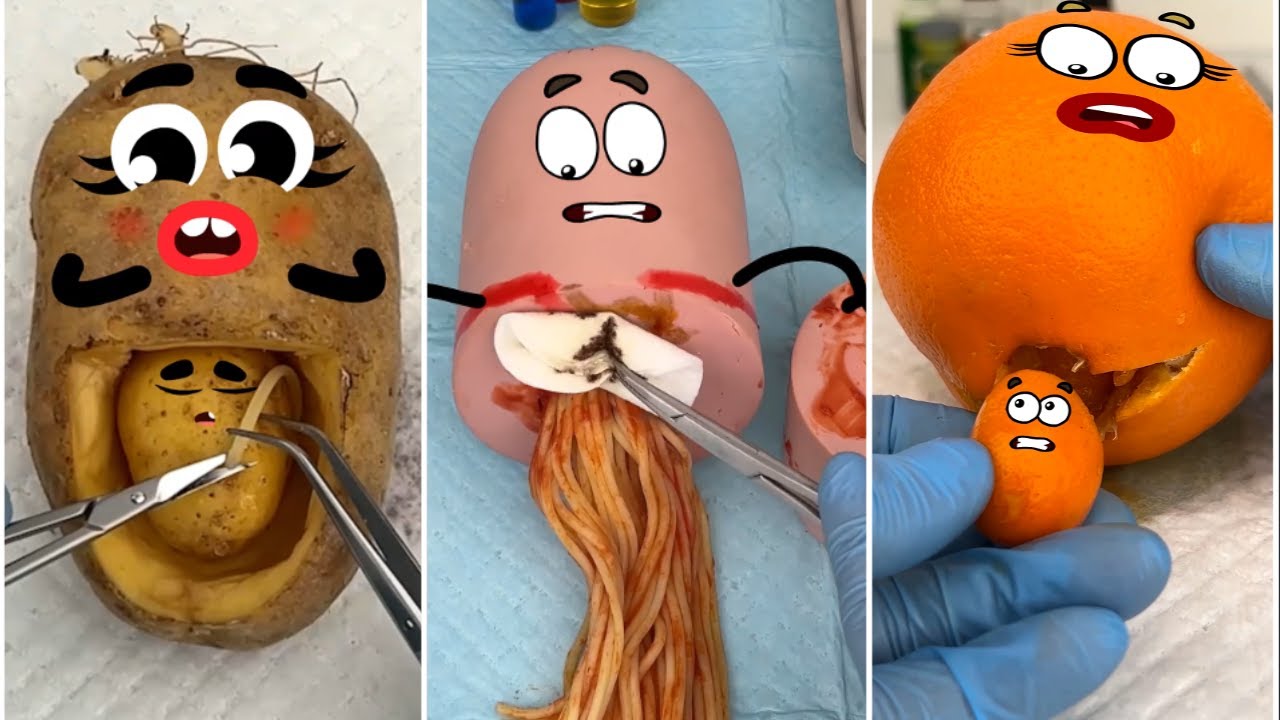 #5 I Tried Food Surgery for 30 Days Here's What Happened - YouTube