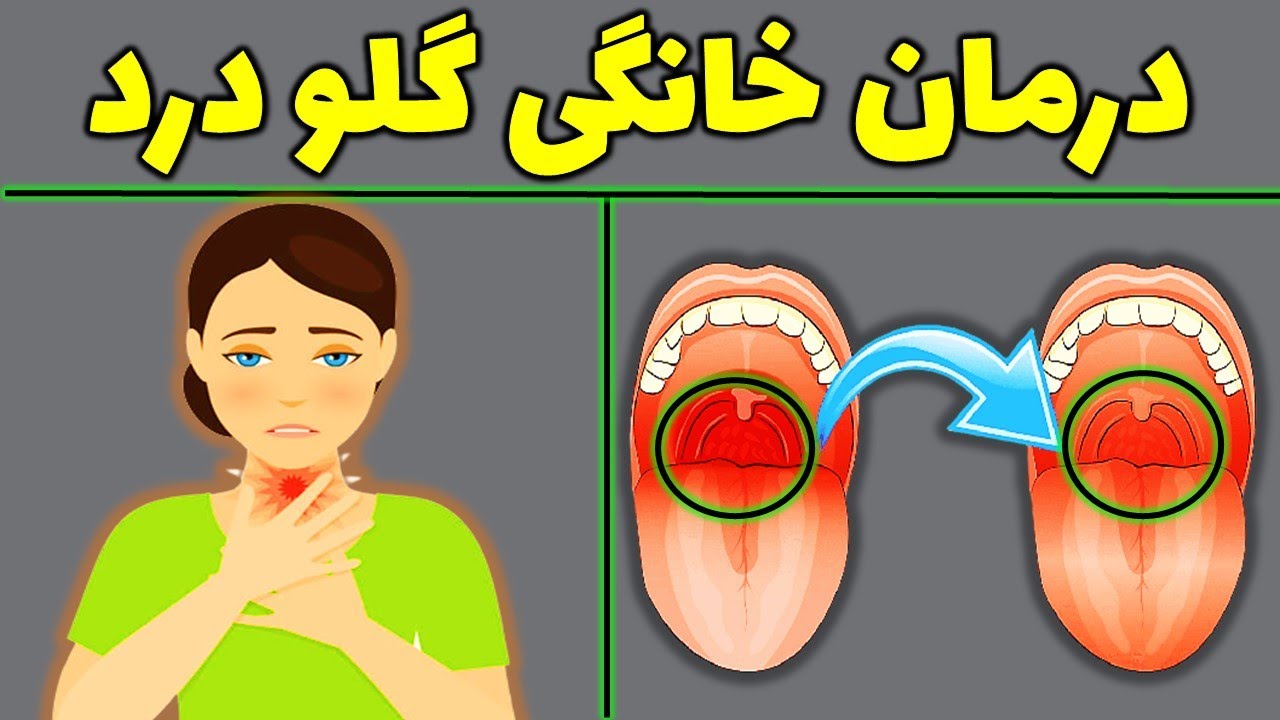 درمان گلودرد در خانه درمان فوری گلودرد درمان خانگی گلودرد Youtube