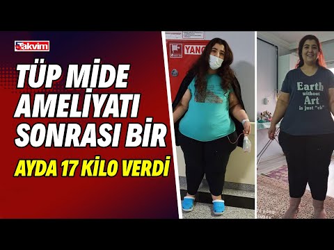Ebe Elife, tüp mide ameliyatı sonrası bir ayda 17 kilo verdi