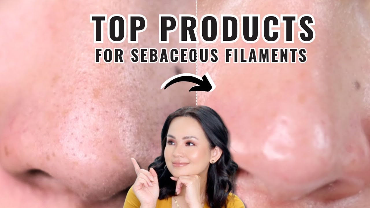 Black Dots on the Nose? Tried & Tested Products to Treat Sebaceous ...