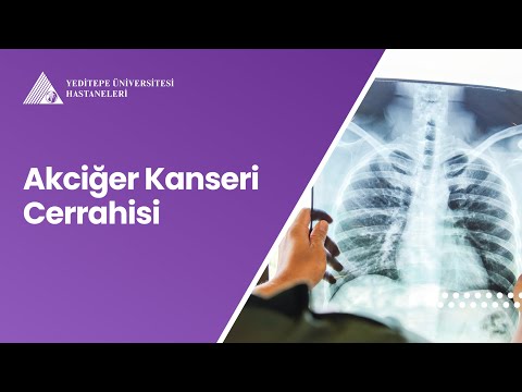 Akciğer Kanseri Ameliyatı | Op. Dr. Ali Fuad Durusoy