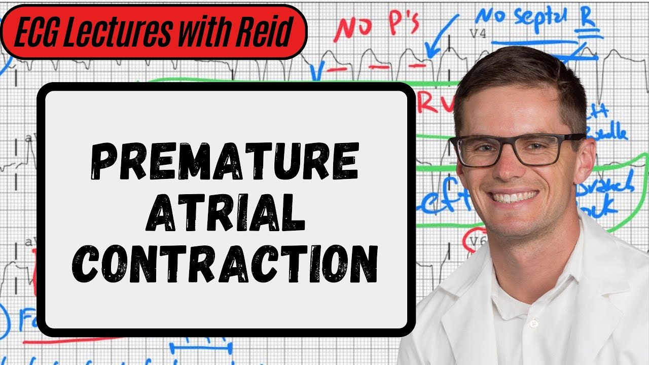 Premature Atrial Contractions | Day 2 ECG Challenge - YouTube