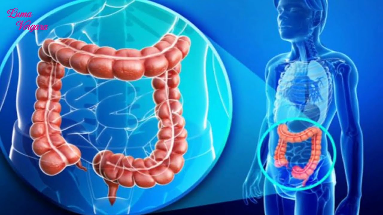 Colonoscopia - Como é Feito o Exame - YouTube