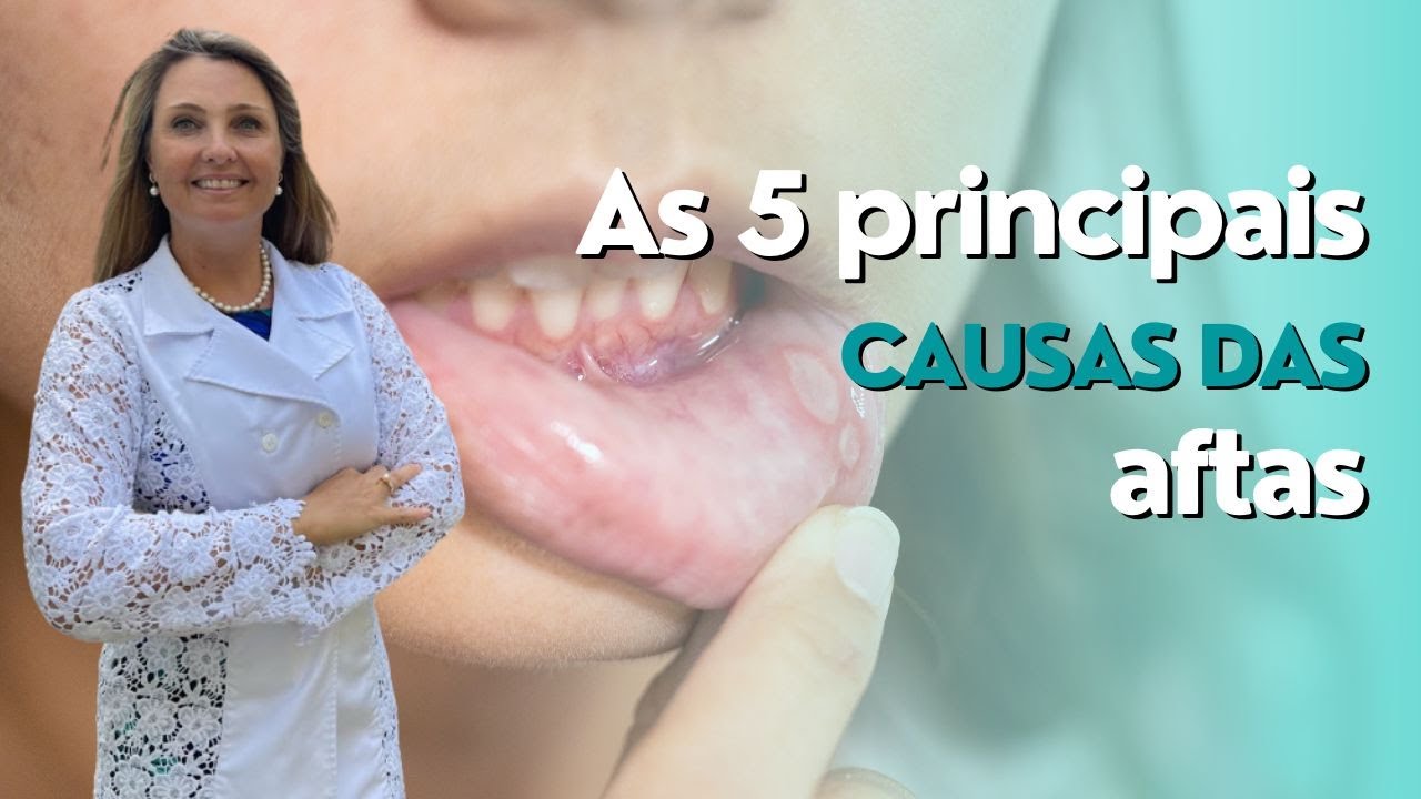 5 PRINCIPAIS CAUSAS DA AFTA - @draelizetekaffer - YouTube
