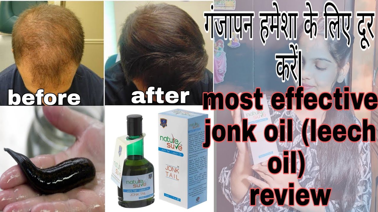 No more Baldness | Nature Sure Jonk Tail (Leech Oil) Review | Jonk Oil ...