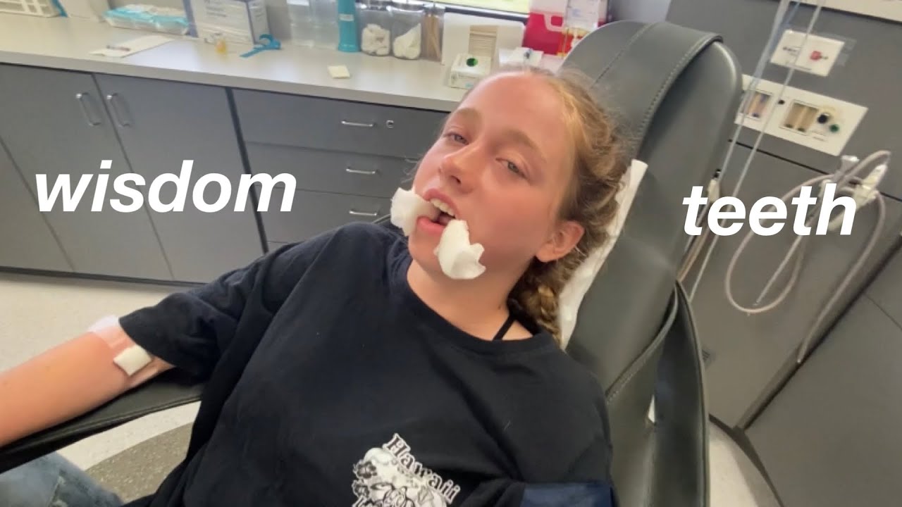 WISDOM TEETH REMOVAL VLOG *very funny* - YouTube