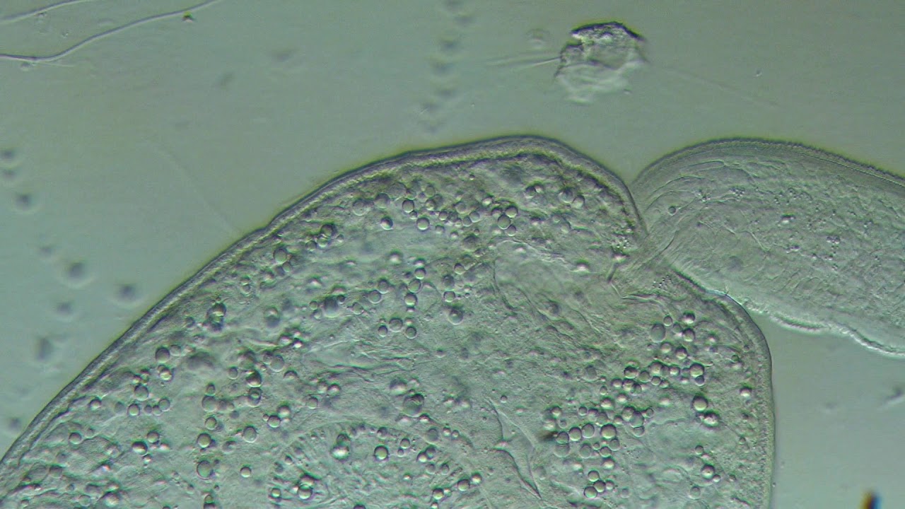 Cercaria (trematode larva) - YouTube