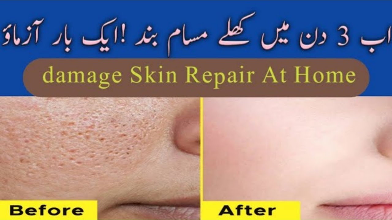 How to get large open pores/ permanetly 5 day and all open pores will ...