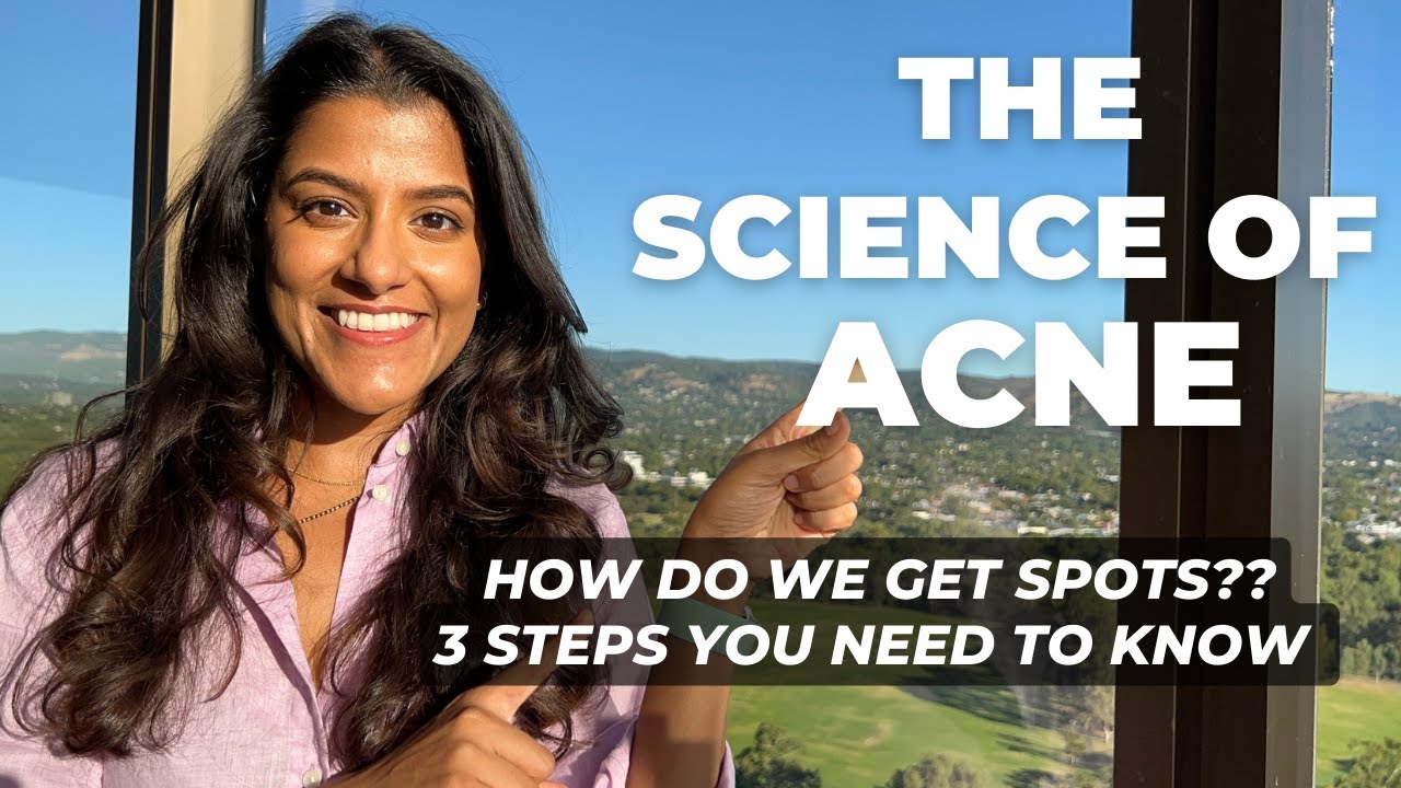 What you NEED TO KNOW to help and improve ACNE and BLACKHEADS! 3 STEPS ...