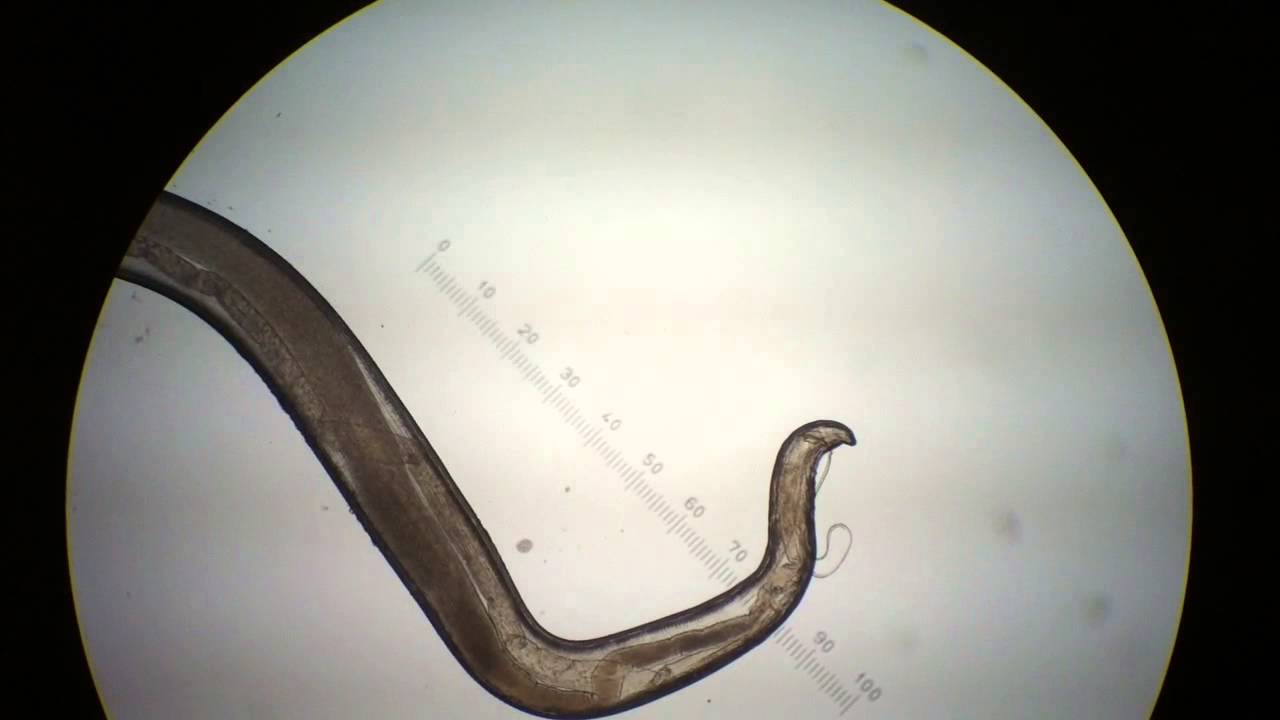 Thelaziasis "eye worm" - YouTube