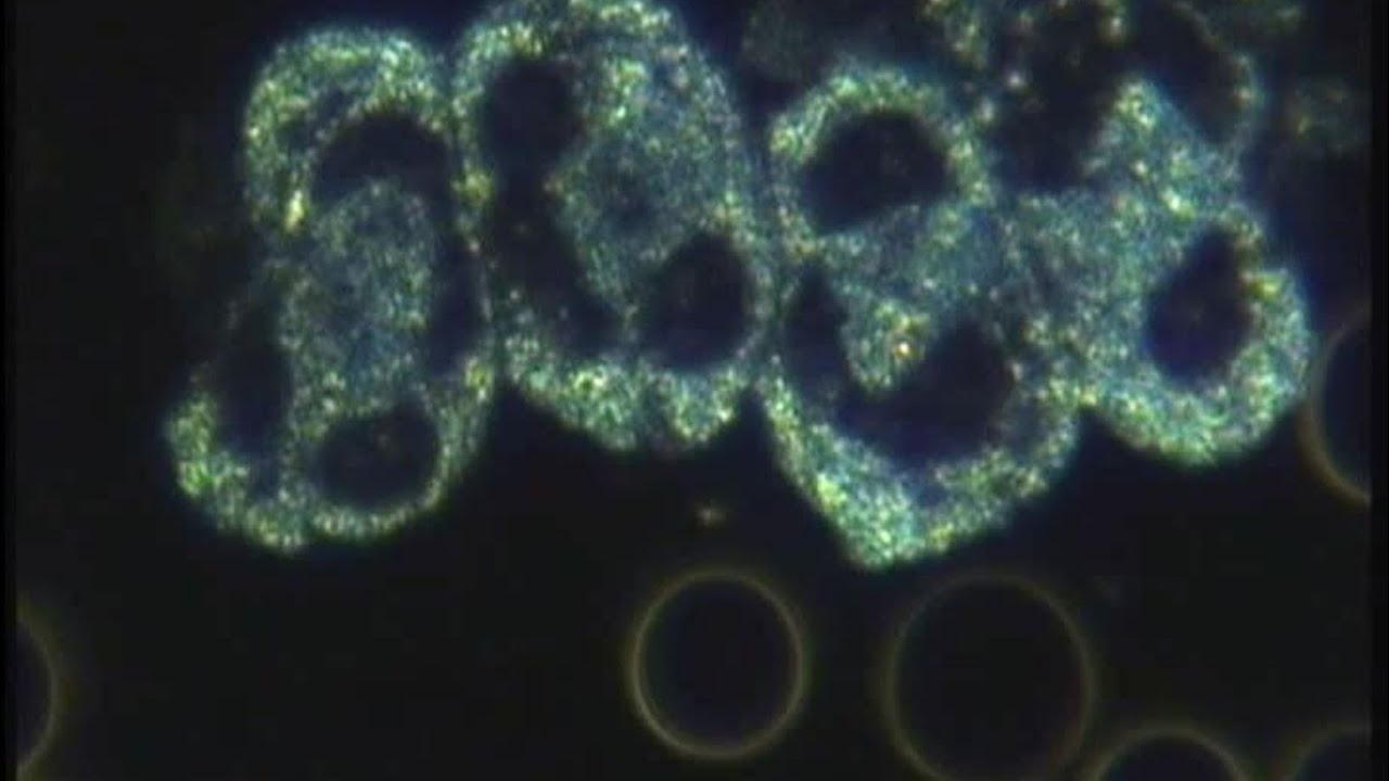 Can I Buy A Cheaper Microscope Online For Live Blood Analysis Live can-i-buy-a-cheaper-microscope-online-for-live-blood-analysis-live