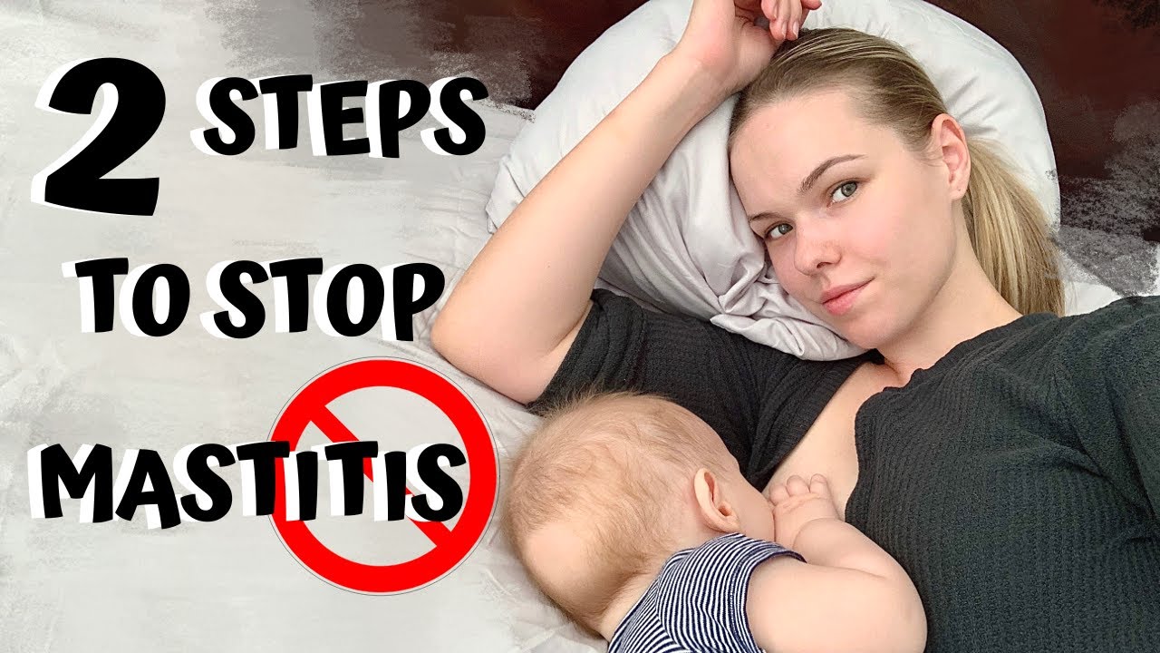 RECURRING MASTITIS JOURNEY: How I Got Rid Of It Naturally, Treating ...