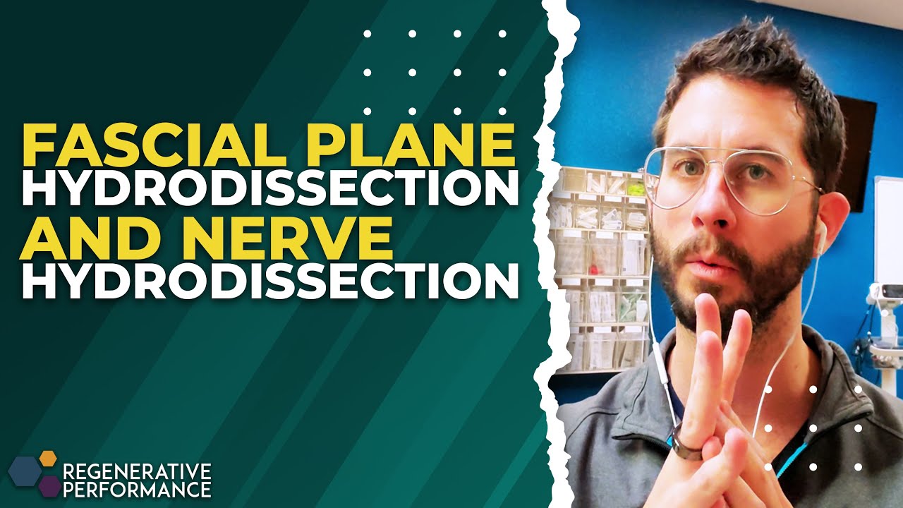 Fascial Plane Hydrodissection and Nerve Hydrodissection | DailyDocTalk ...