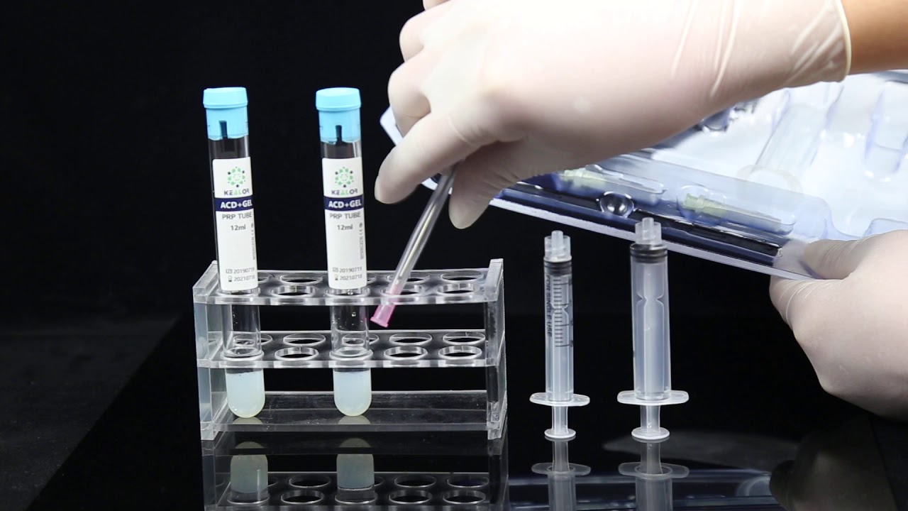 platelet rich plasma separation prp tube/ prp kit /acd gel ha prp - YouTube