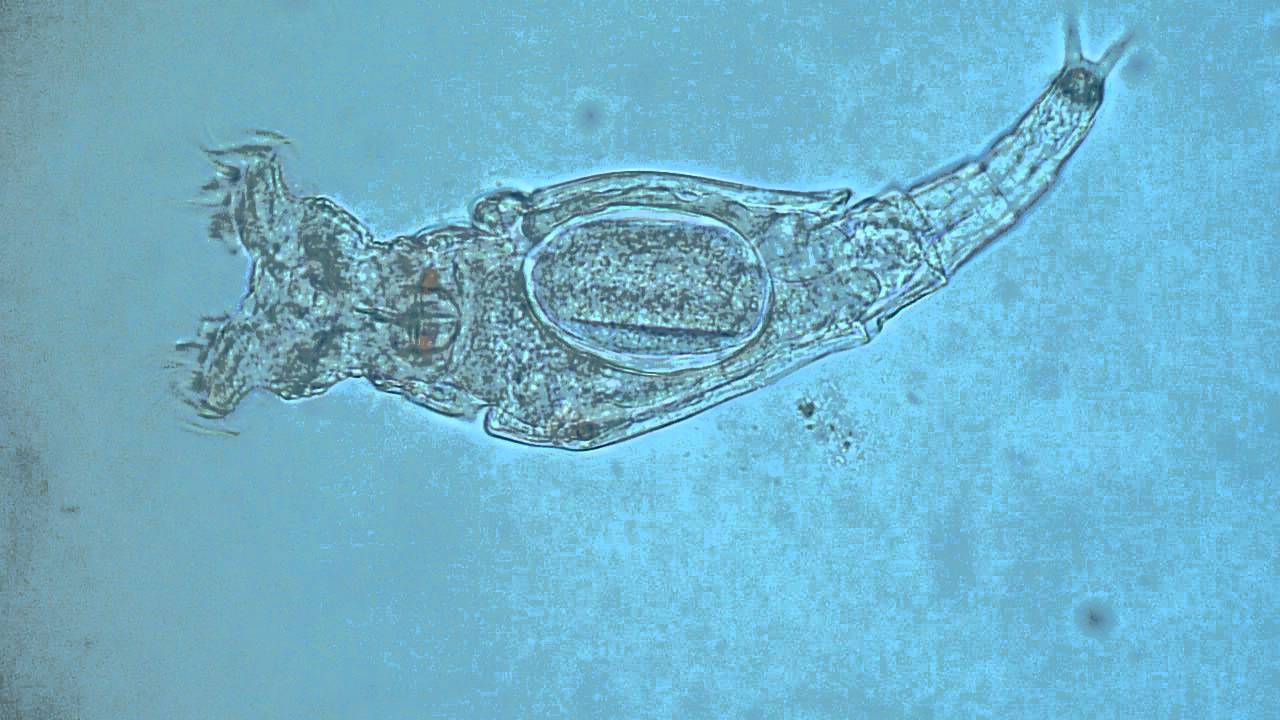 Rotaria rotatoria - YouTube