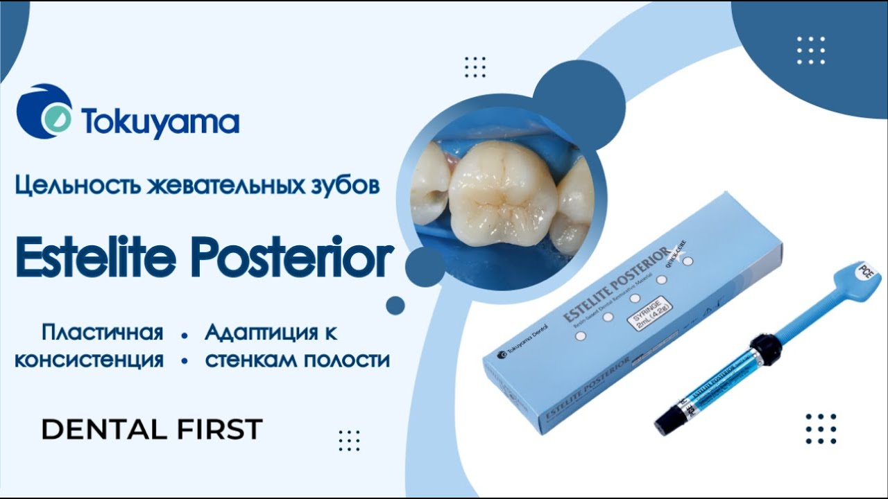Estelite Posterior – ваш идеал в пломбировании объемных полостей ...