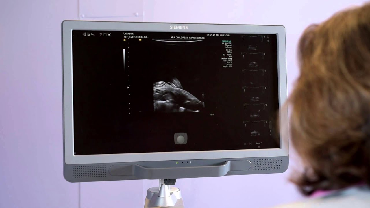 Fish Ultrasound Video 2 - YouTube