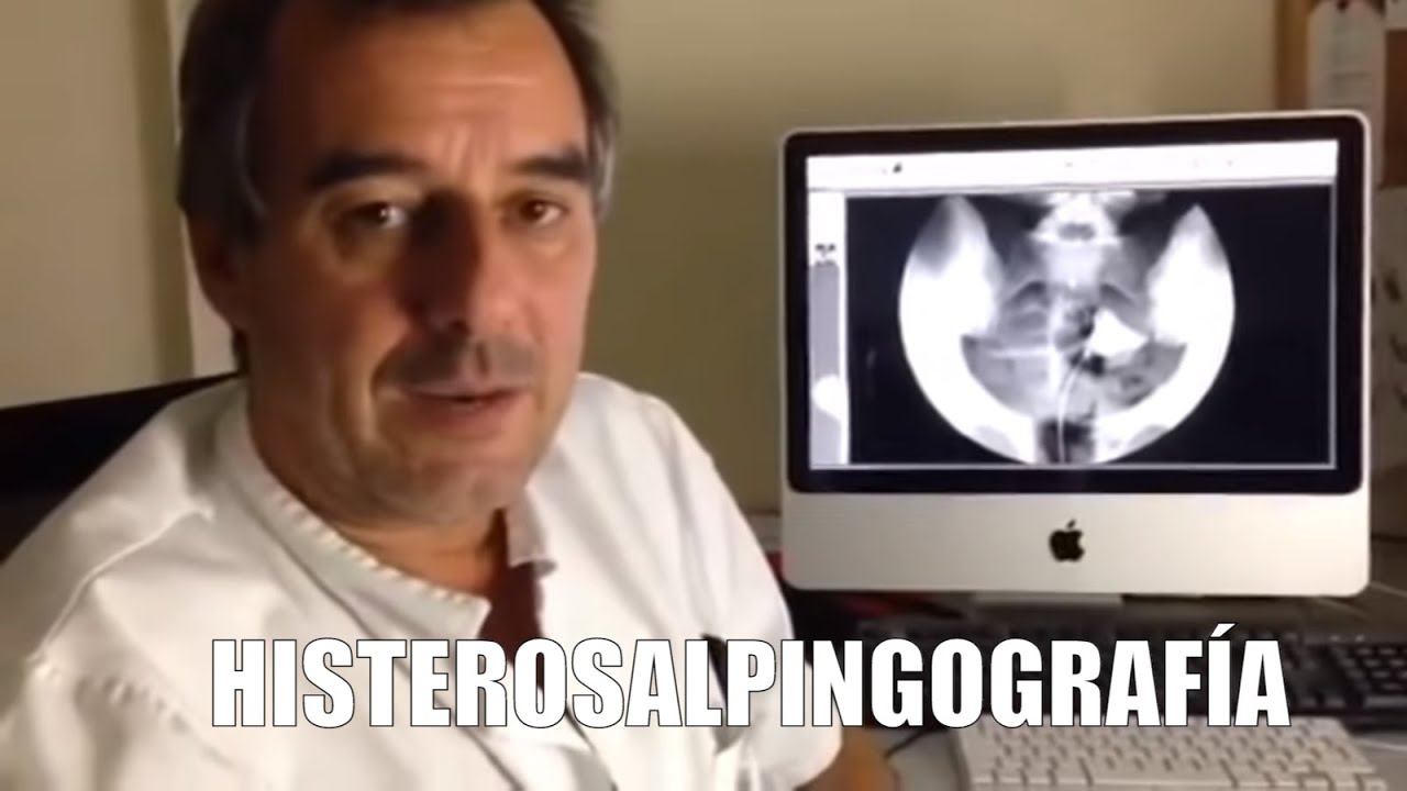 Qué es una Histerosalpingografía ⭐ Dr. Josep Vives Roura - YouTube